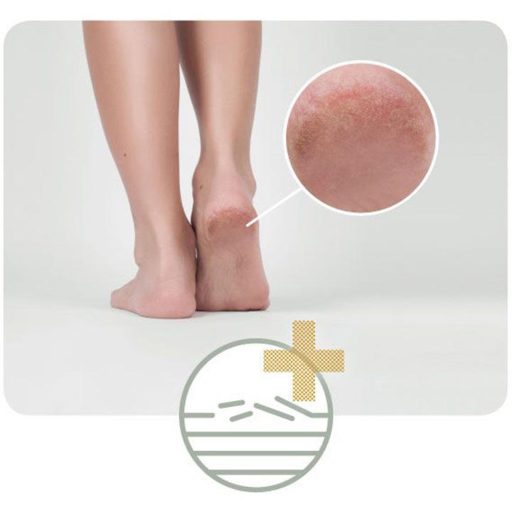 Crema pentru calcaie si piele crapata, cu miere de Manuka, Manuka ...