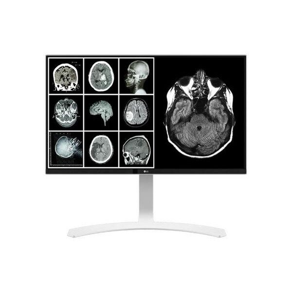 Monitor IPS LED LG 27" 27HJ712C-W, UHD 3840 x 2160, Medical Display ...