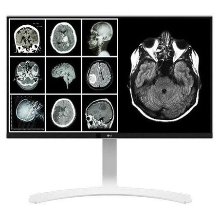 Monitor LED LG Clinical Review 27HJ712C-W 27 inch 14 ms Argintiu DICOM ...