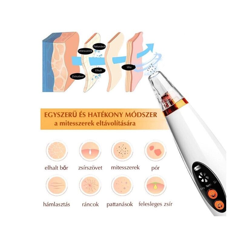 Mitesszer eltávolító szett, CHIGOODS, Fehér - eMAG.hu
