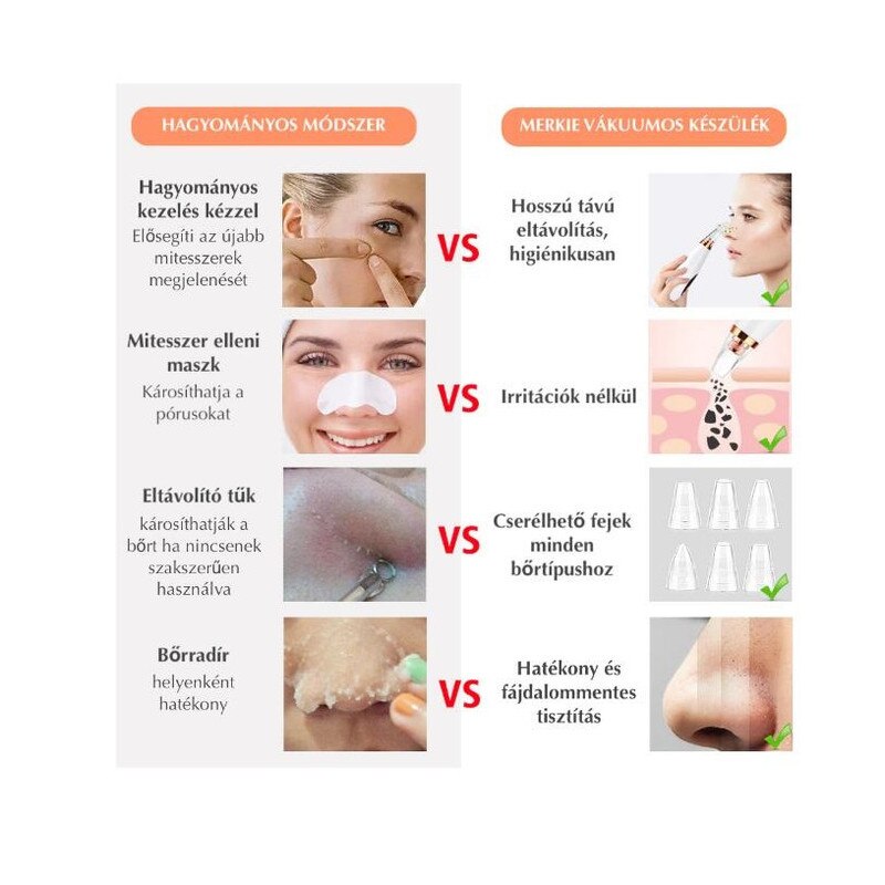 Mitesszer eltávolító szett, CHIGOODS, Fehér - eMAG.hu