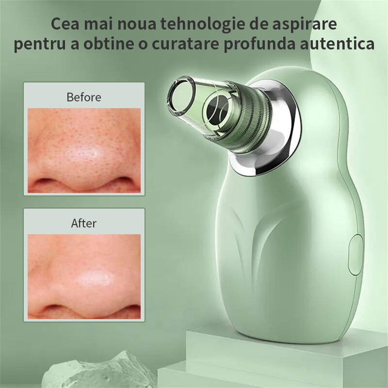 Aparat pentru indepartat puncte negre si puncte de grasime cu vacuum ...