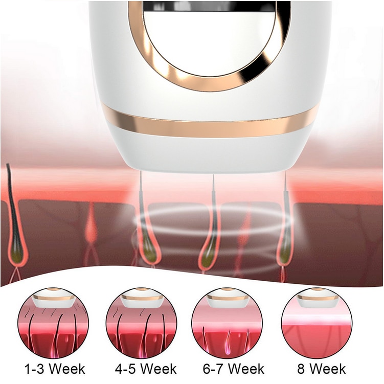 Epilator IPL, clasa Premium, 999.999 pulsatii, epilare definitiva fara ...