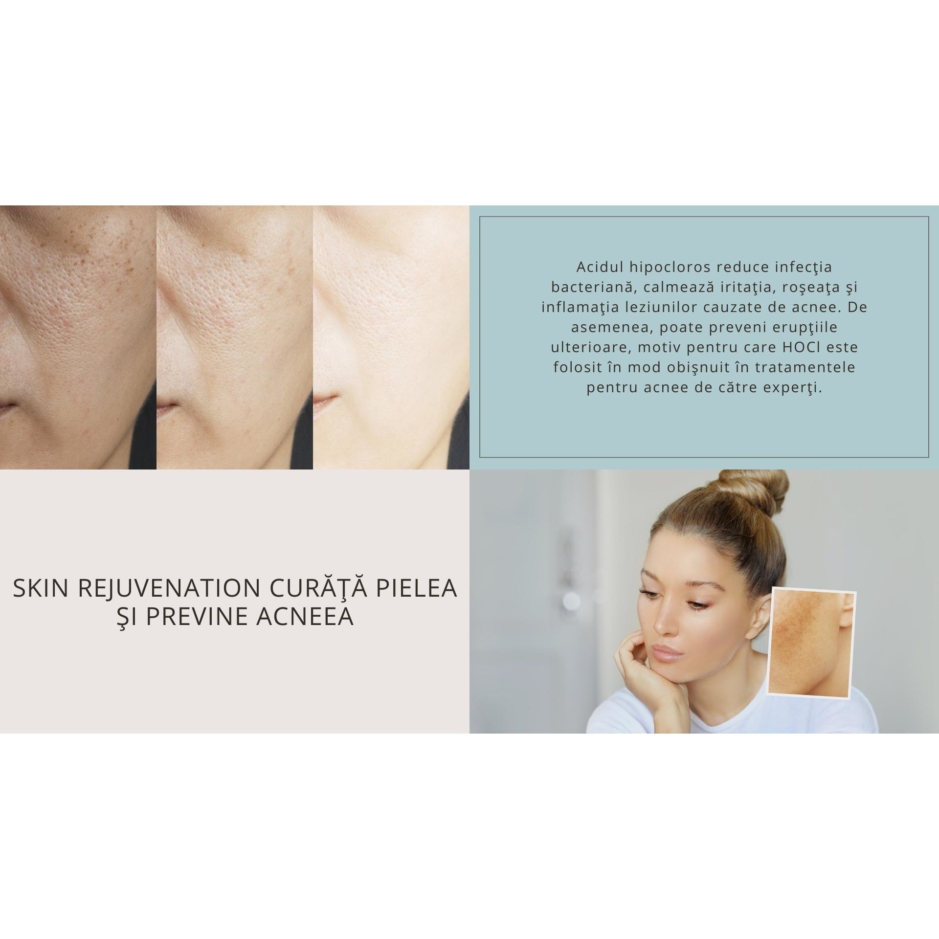 Solutie curatare ten, CliniSafe, Skin rejuvenation, DESINSEPT, 250 ml ...