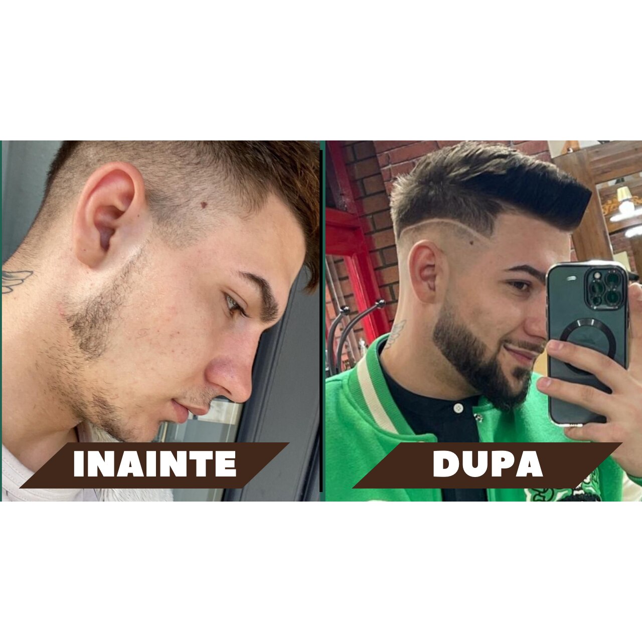 Set impotriva caderii parului, Solutie Kirkland Signature, Pipeta ...