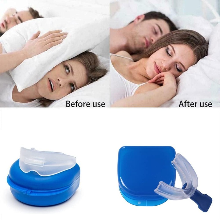 Устройство против хъркане JENUOS, 4 назални дилататора, Предпазител за ...