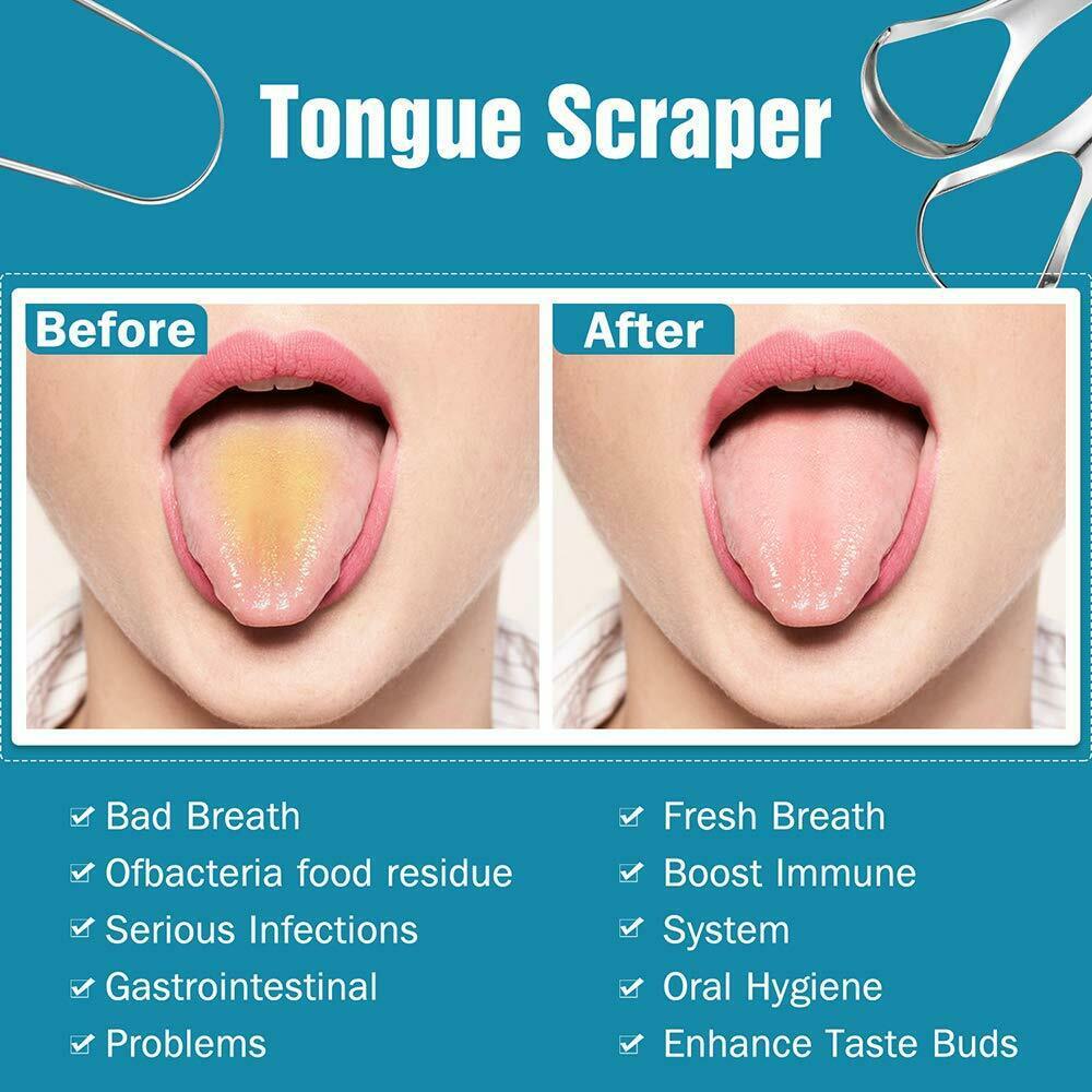 Set Racleta/Perie portabila pentru limba, Inox, 3 bucati, Argintiu ...