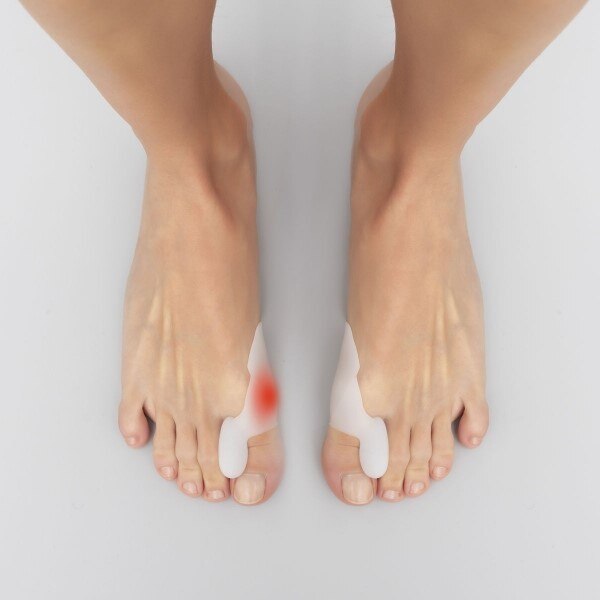 Corector monturi si Separator degete de la picior, din silicon moale ...