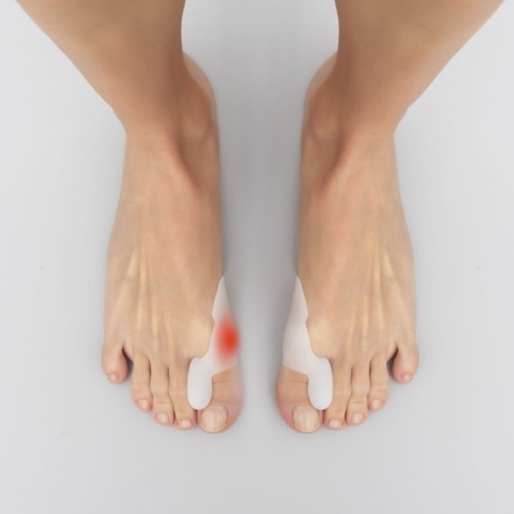 Corector monturi si Separator degete de la picior, din silicon moale ...