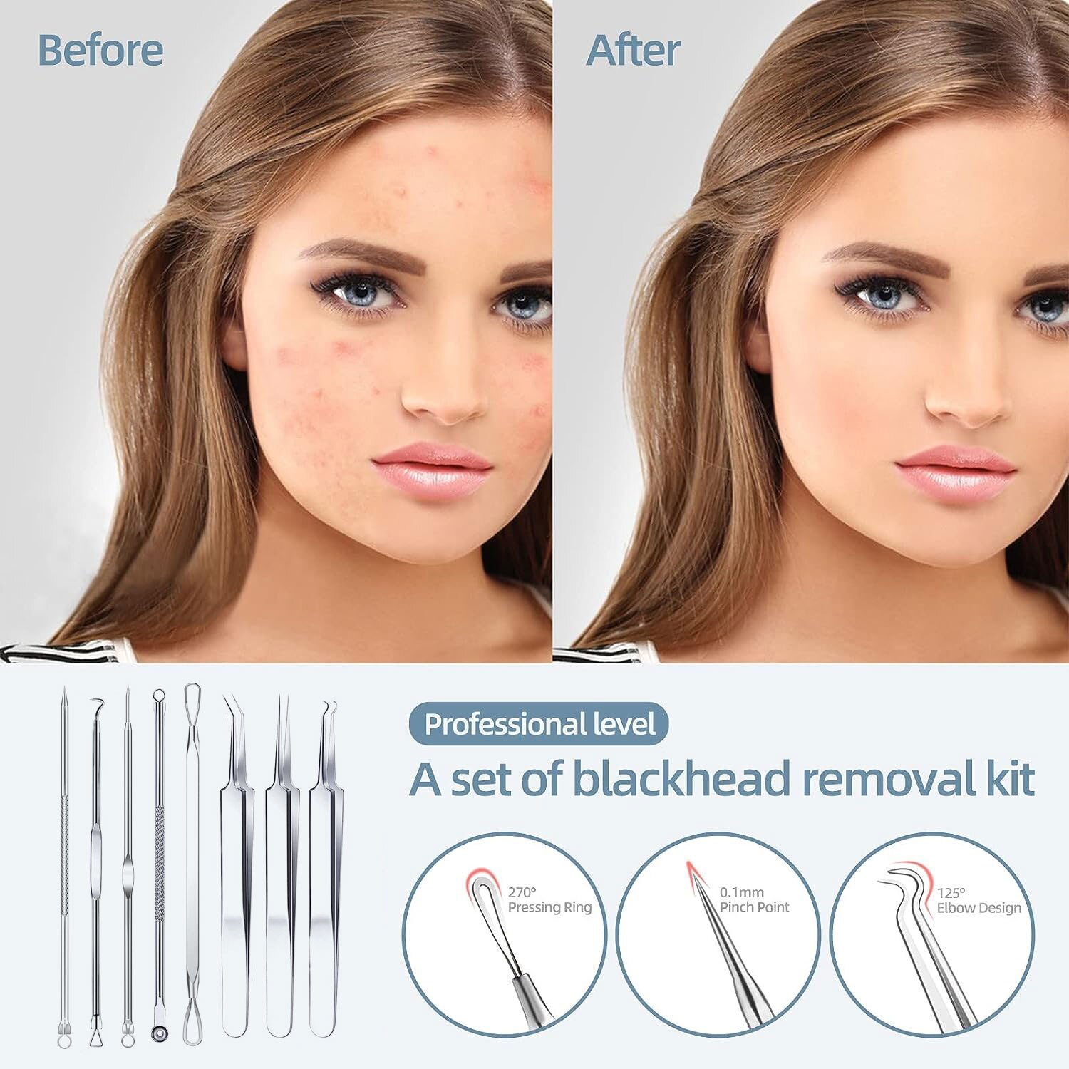 Set 8 pensete pentru extractie puncte negre, comedoane, acnee ...