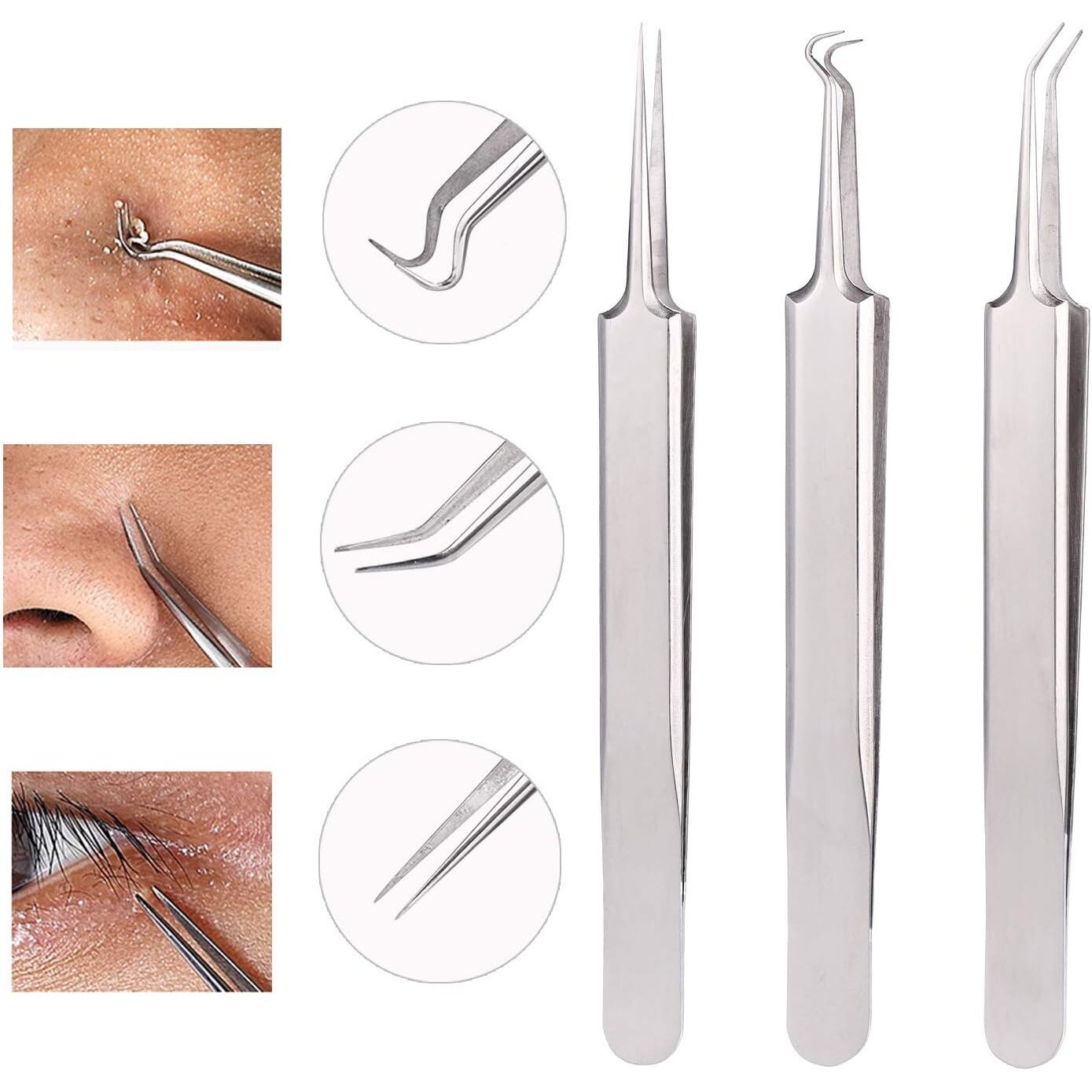 Set 8 pensete pentru extractie puncte negre, comedoane, acnee ...