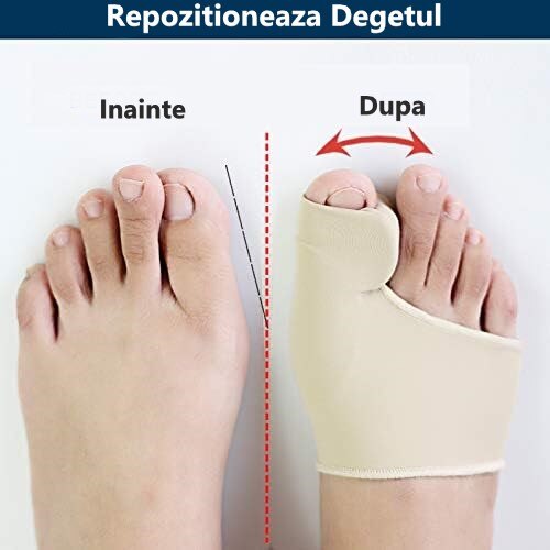 Set 2 protectii pentru monturi tip soseta si separator degete din ...