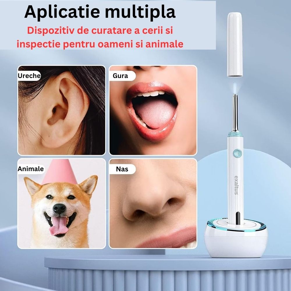 Otoscop Premium, Exaltus®, Aparat de curatare urechi multifunctional ...