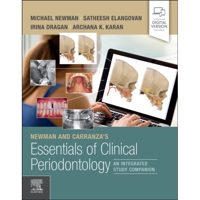 Newman and Carranza's Essentials of Clinical Periodontology de Michael ...