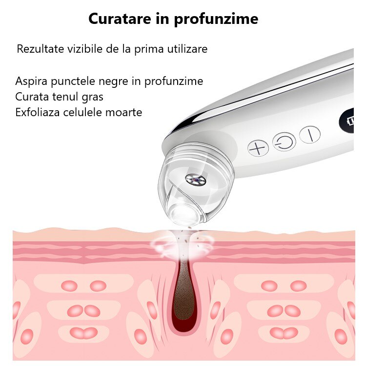 Aparat de scos cosuri si punctele negre XPD, multifunctional, aspirator ...