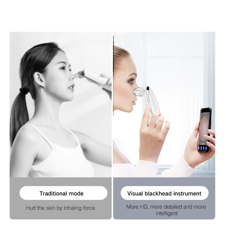 Aparat de scos cosuri si punctele negre XPD, multifunctional, aspirator ...