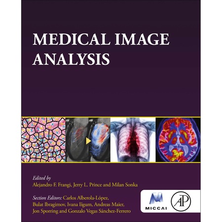 Medical Image Analysis de Alejandro Frangi - eMAG.ro