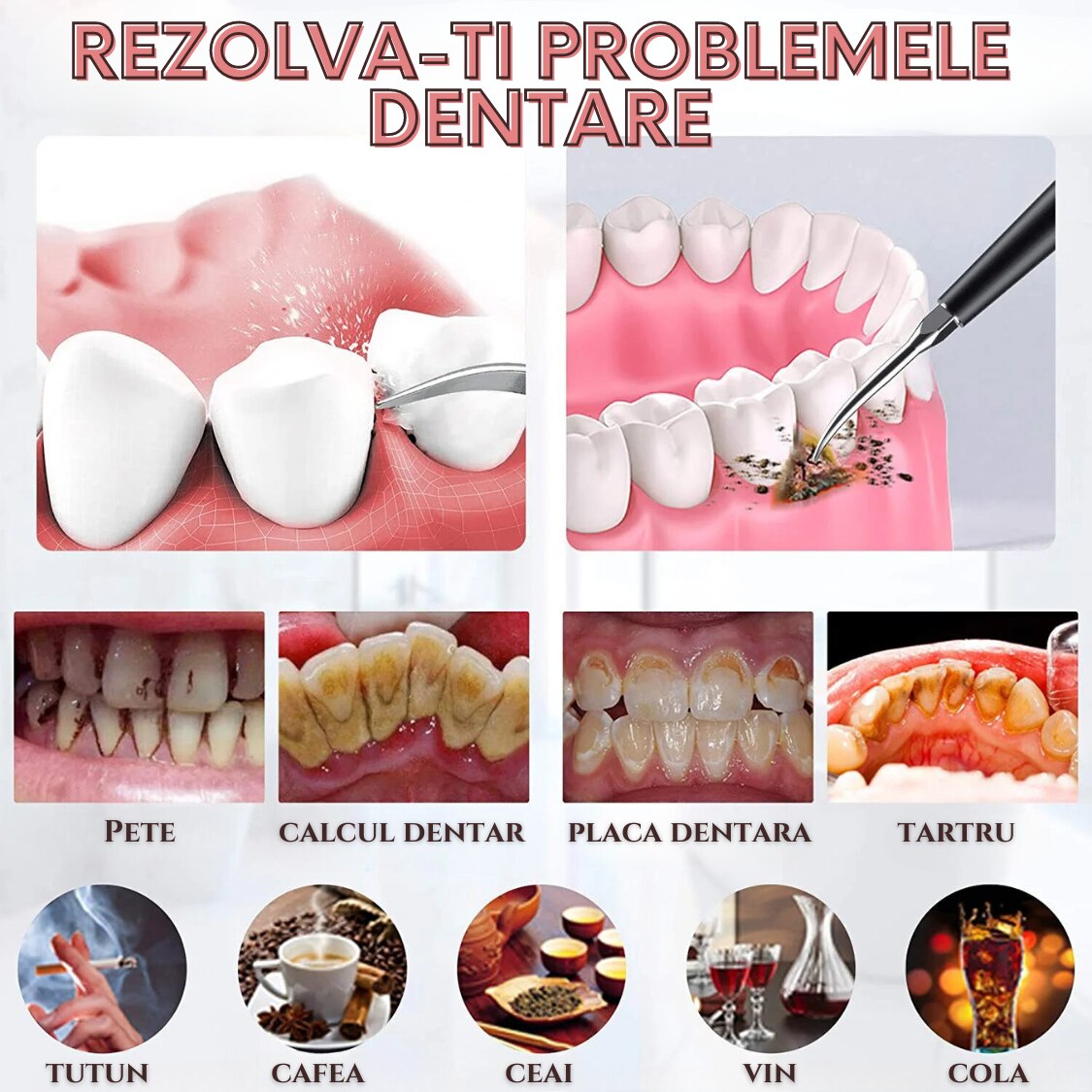 Aparat pentru Detartraj, Richyes®, Dispozitiv pentru Eliminare Tartru ...