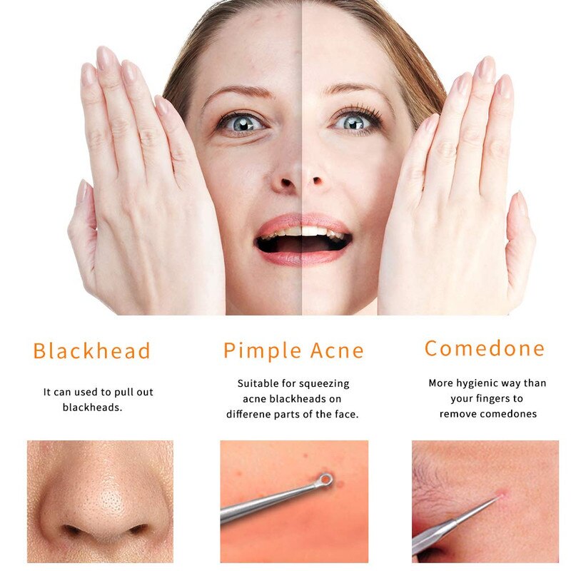 Set 4 Pensete pentru Extractie, Aisdelu®, lungime de 12 cm, Extractie ...