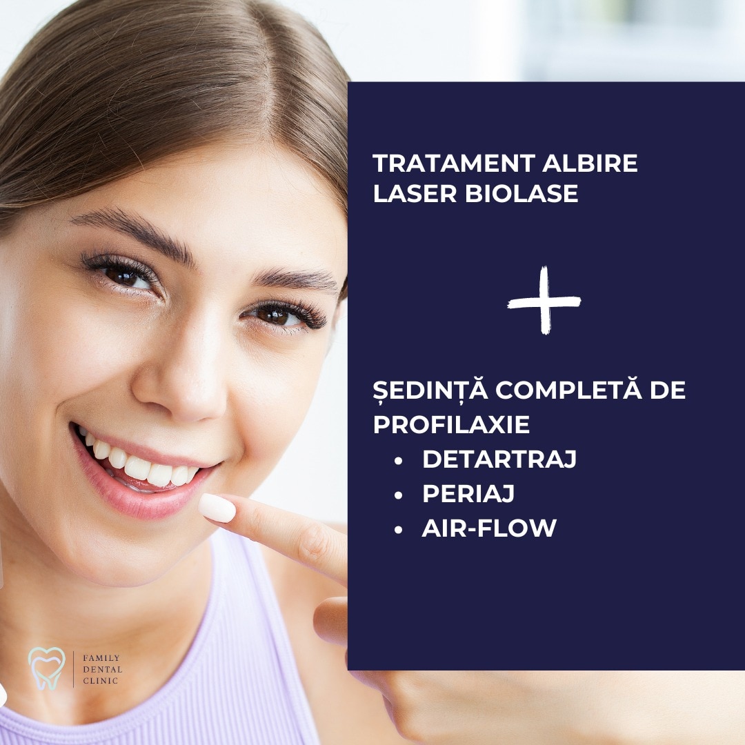 Pachet Servicii stomatologice "Tratament albire laser, profilaxie ...