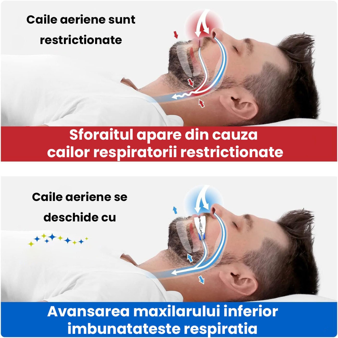 Gutiera antisforait, YHJ, Better Sleep, bruxism, din silicon, alb - eMAG.ro