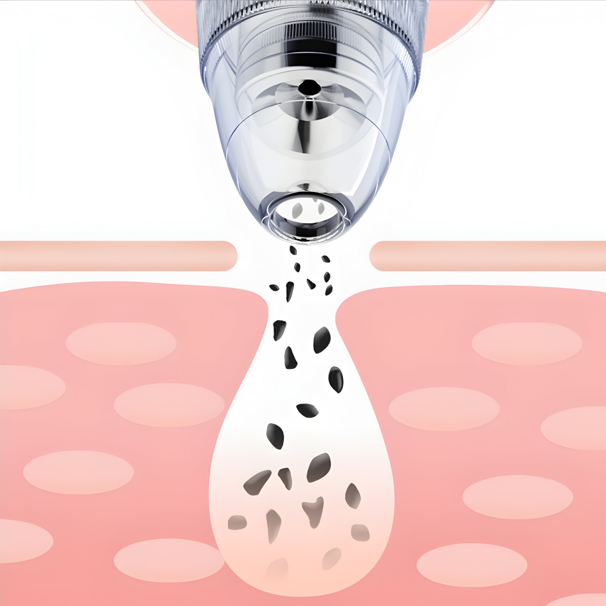 Aparat Impotriva Punctelor Negre, 3 Niveluri De Ajustare, Stimularea ...