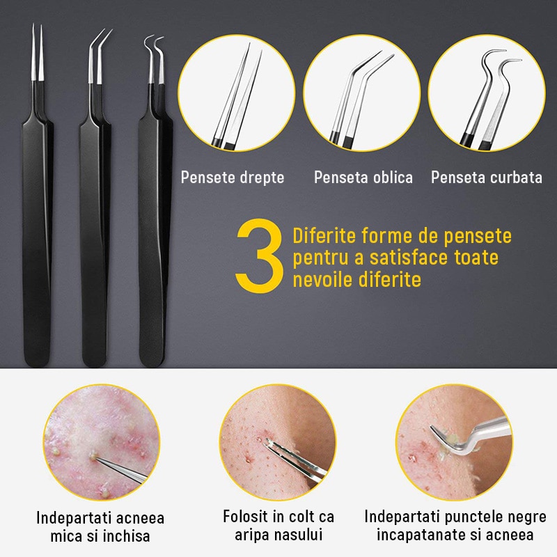 Set 10 pensete pentru extragerea punctelor negre, FMK, Inox, 14.5 x 2.8 ...