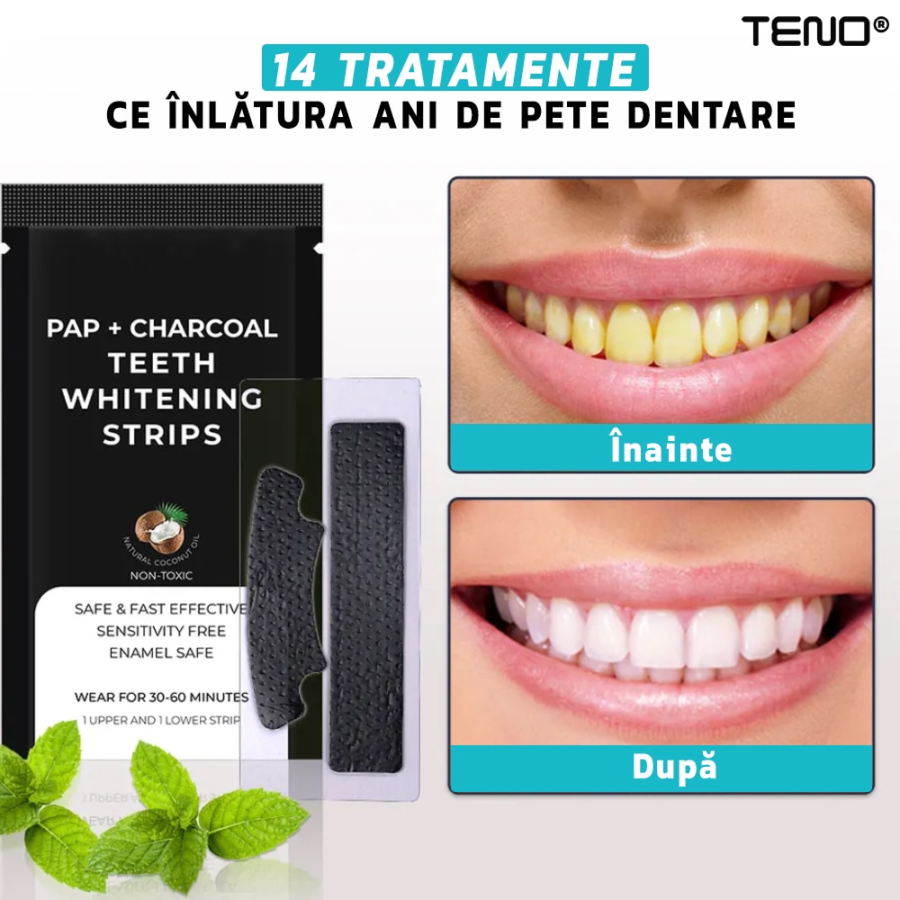 Set 24 Benzi pentru Albirea Dintilor Teno®, IVISMILE, Carbune Activ si ...