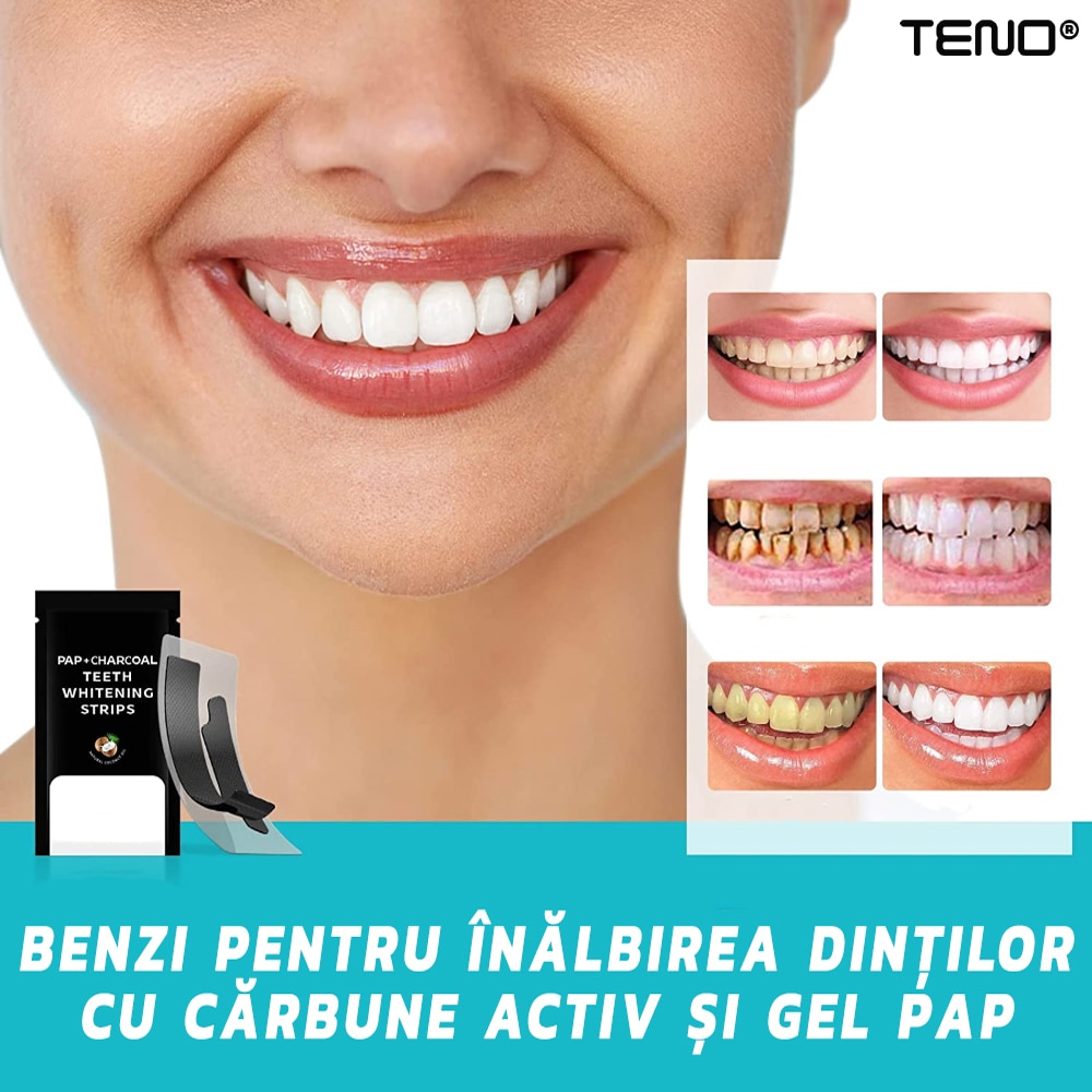 Set 24 Benzi pentru Albirea Dintilor Teno®, IVISMILE, Carbune Activ si ...