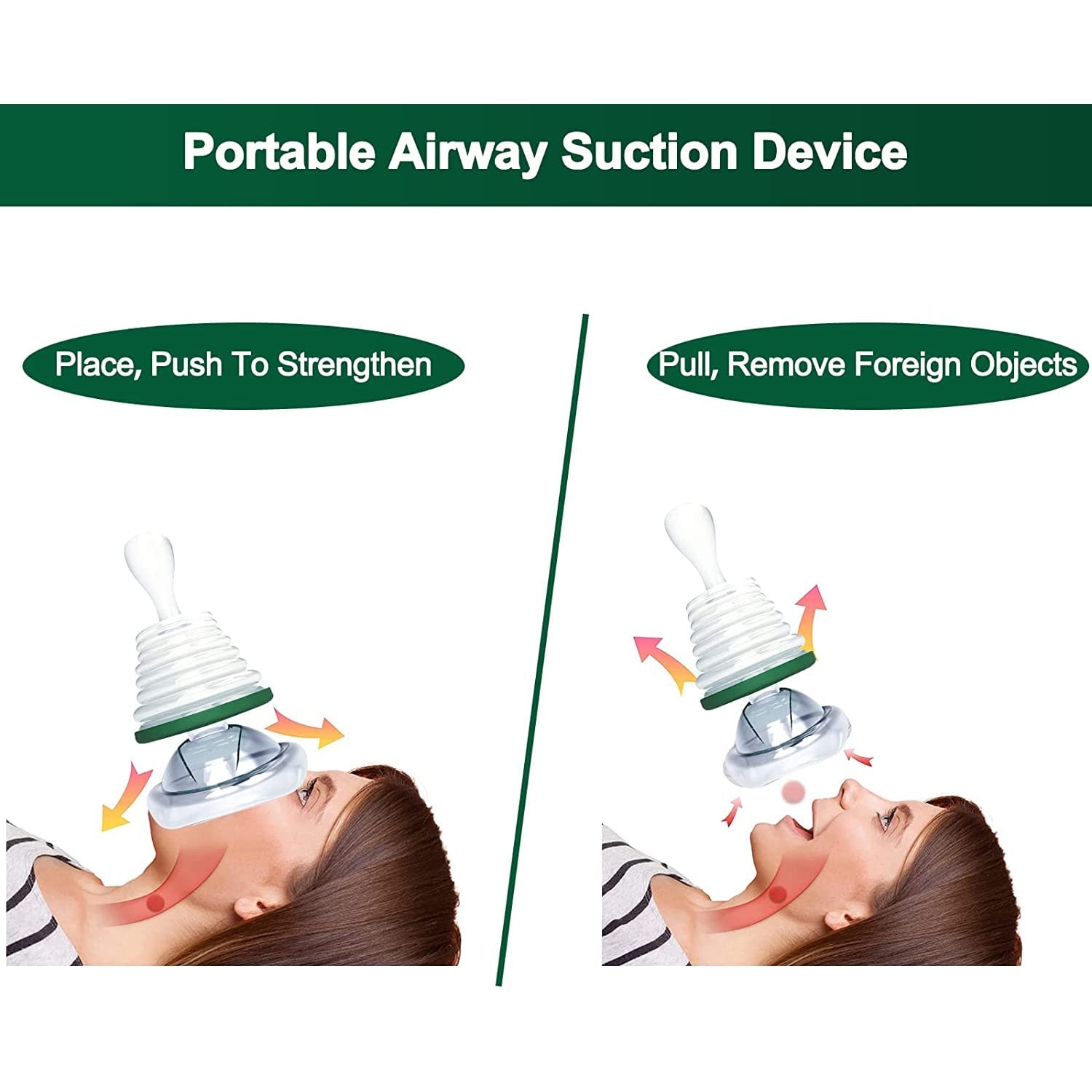 Fulladásgátló készülék a légutak felszabadítására fulladás esetén ...