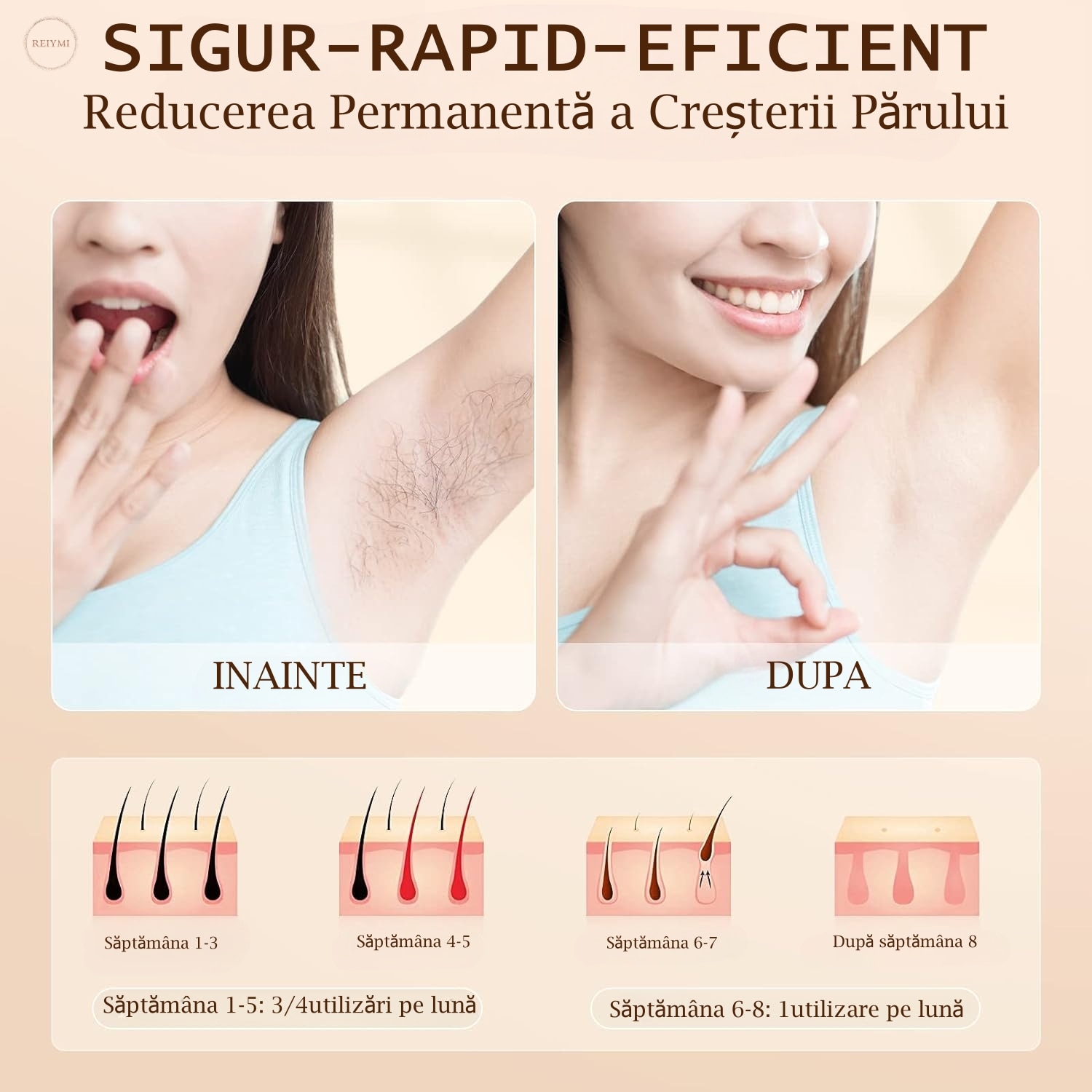 Epilator IPL cu laser, epilare definitiva fara durere, 999.999 impulsuri, Tehnologie IPL, 5 ...