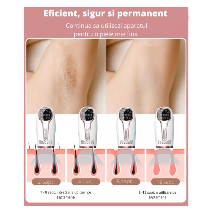 Epilator IPL chigoods®, epilare definitiva fara durere, 999.999 ...