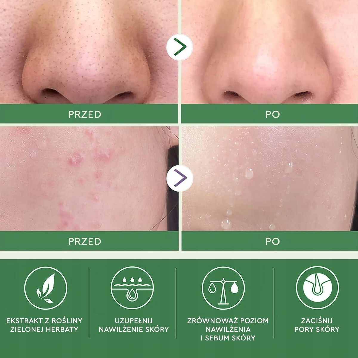 Arcmaszk, Melao, Zöld tea, Mitesszer eltávolítás, 40 g - eMAG.hu