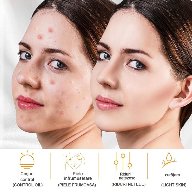 Electroderm cosmetic portabil cu 4 electrozi, Tratament cu Frecventa ...