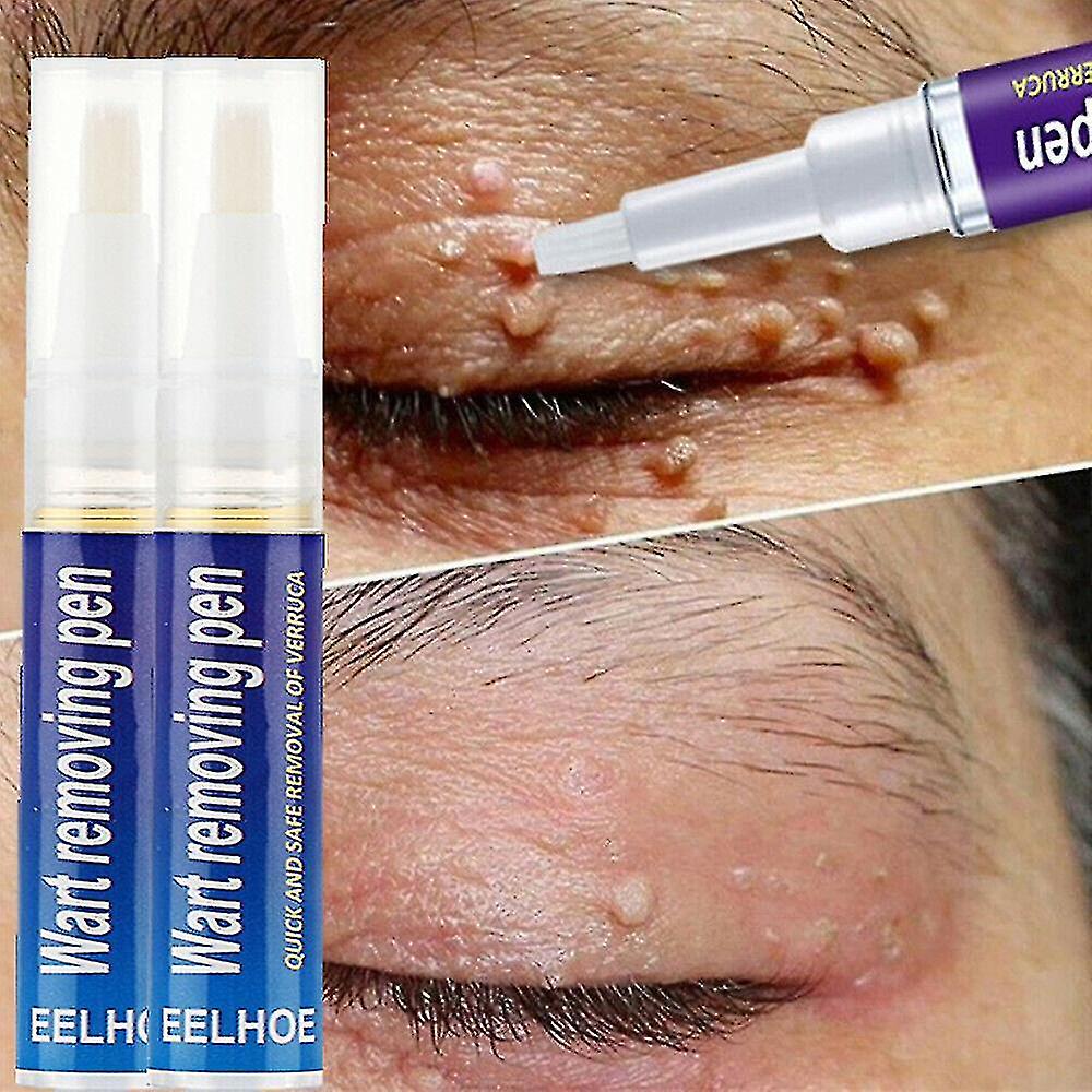 Crema pentru tratare negi, Eelhoe, Multicolor - eMAG.ro