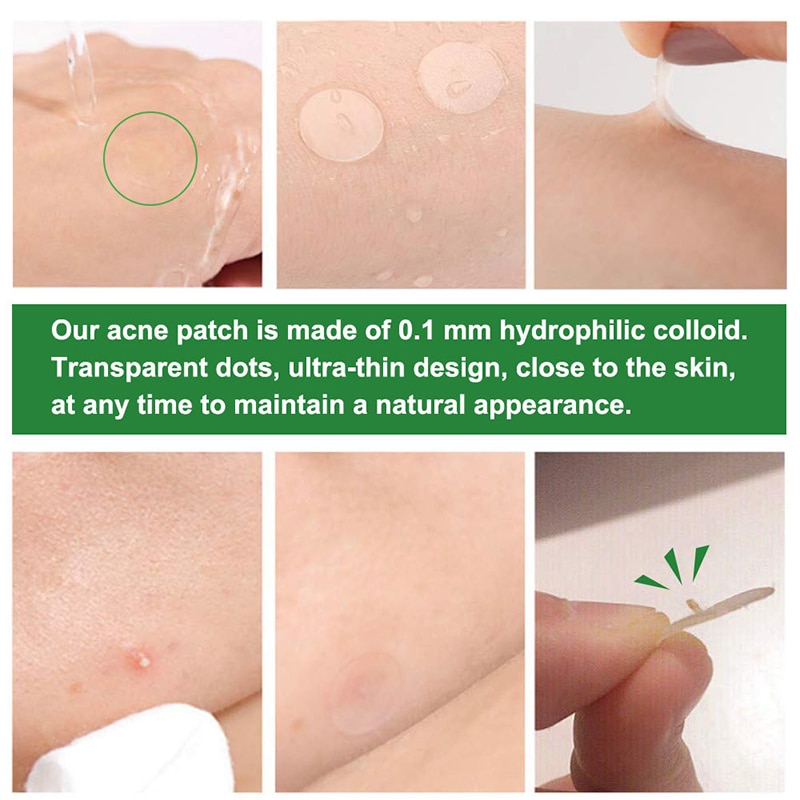 Platuri pentru cosuri, Elaimei, 24 plasturi, Transparent - eMAG.ro