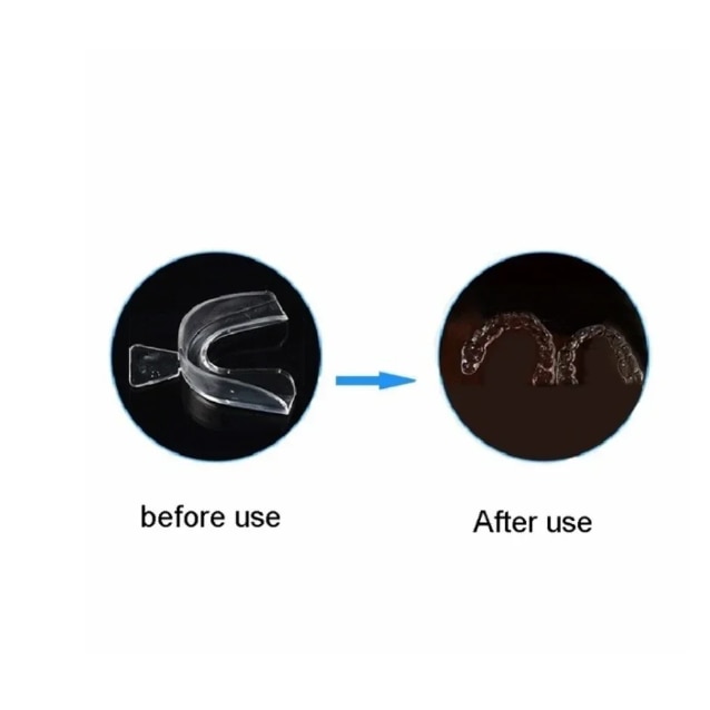 Set 2 gutiere transparenta si adaptabila pentru relaxarea maxilarului ...