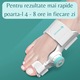 Corector Ortopedic Monturi, cu Atela reglabila, pentru Ameliorarea ...