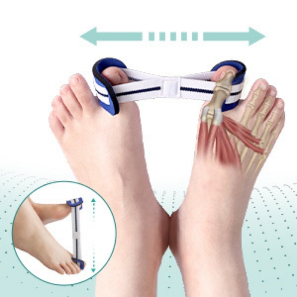 Corector Ortopedic Monturi, pentru Corectarea, Tratarea si Indreptarea ...