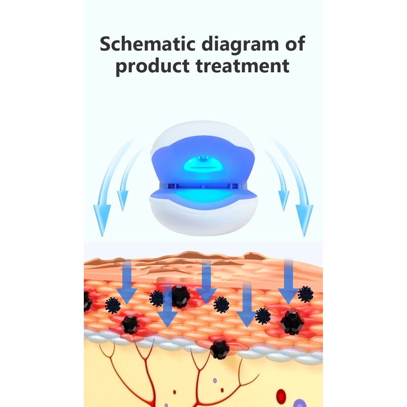 Dispozitiv laser pentru indepartare onicomicoza, ciupercii unghiilor ...