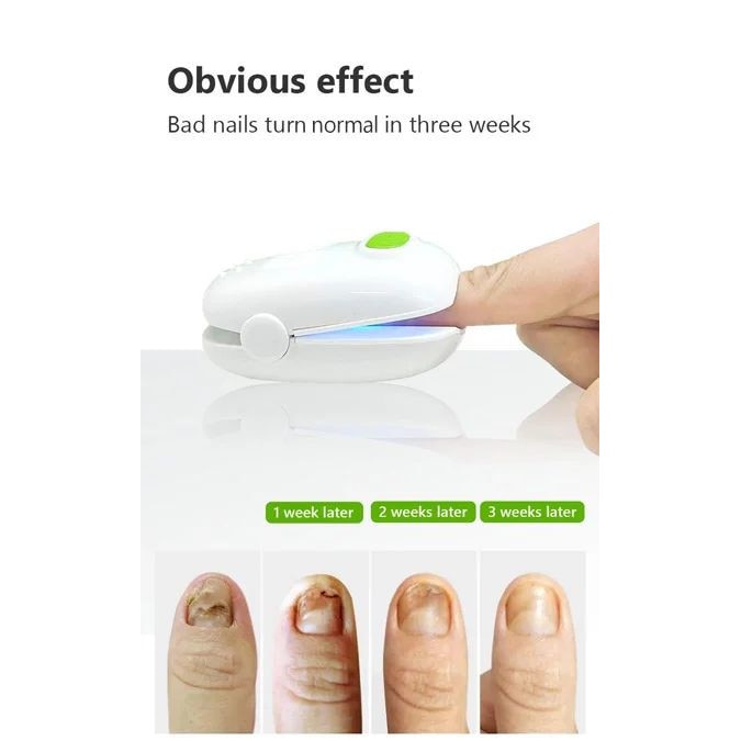 Dispozitiv laser pentru indepartare onicomicoza, ciupercii unghiilor ...