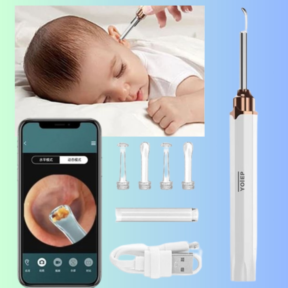 Устройство за проверка и почистване на уши YOTEP, Отоскоп, HD 1080p ...