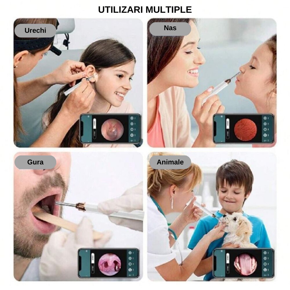 Dispozitiv pentru inspectarea si curatarea urechilor YOTEP, Otoscop ...