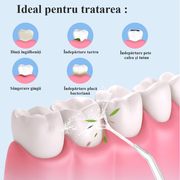 Irigator bucal portabil, HYT, 4 Capete Curatare Anti-Tartru, Rezervor ...