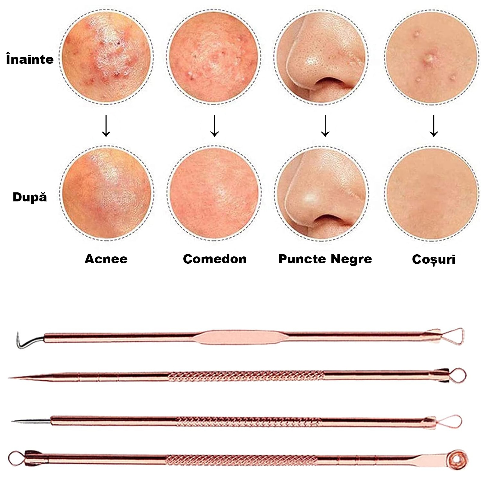 Уред за третиране на лице и подмладяване на кожата 5 в 1 Novary мезотерапия лифтинг против