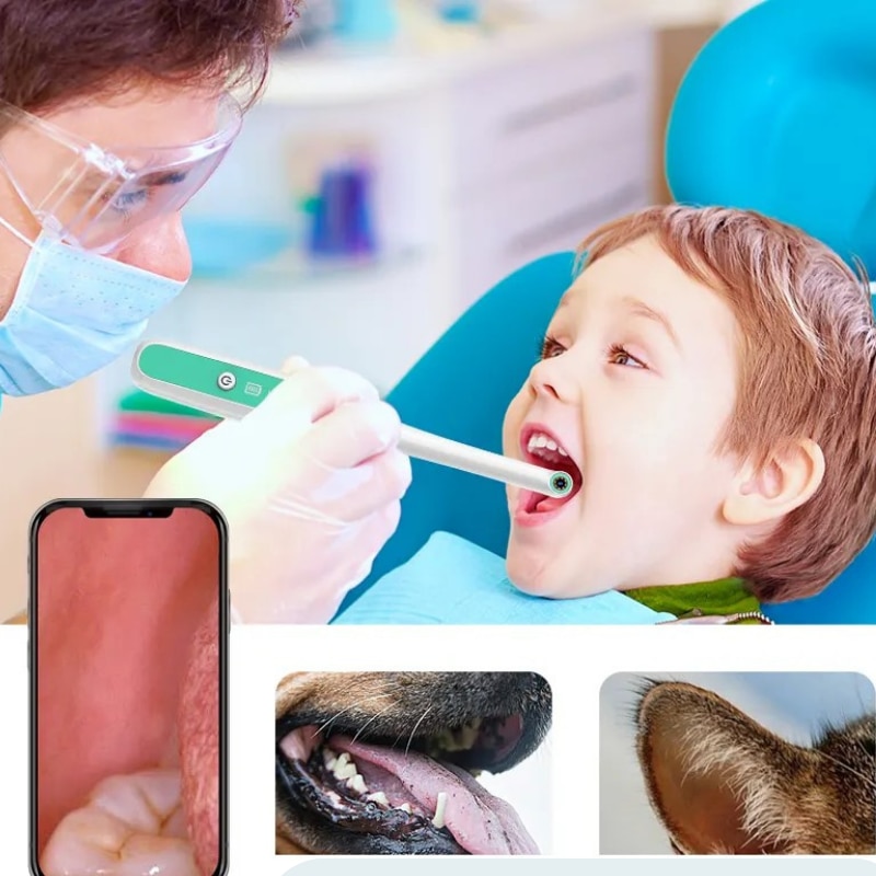 Camera intraorala inalambrica, inspectie orala, endoscop oral - eMAG.ro