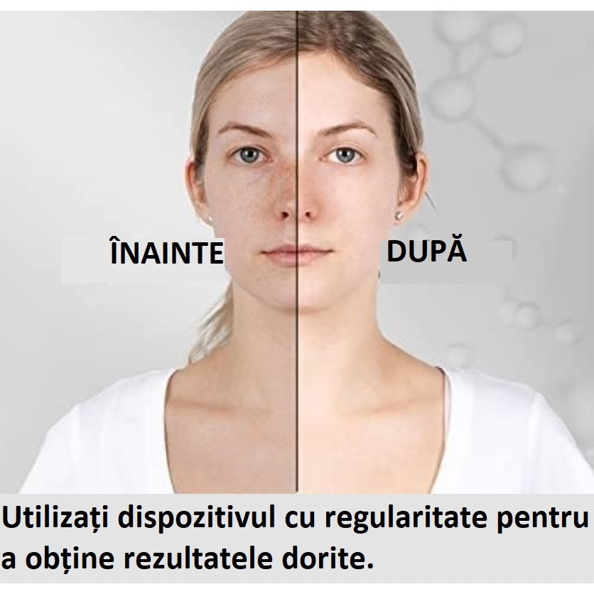 Dispozitiv Profesional Pentru Masaj Facial, Combate Ridurile Si Efectul ...