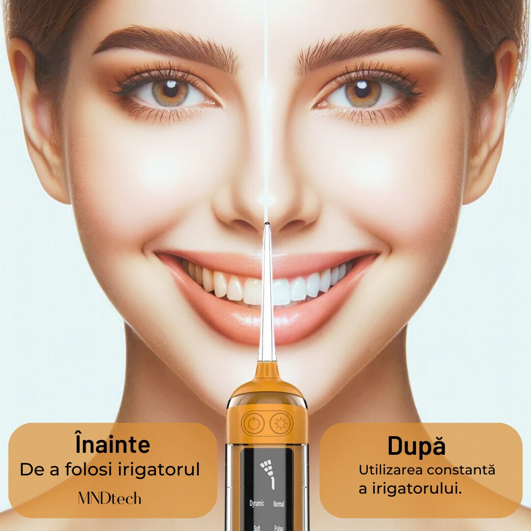 Irigator Bucal Profesional 6-in-1 MNDtech - tip Dus Oral cu 8 Duze ...