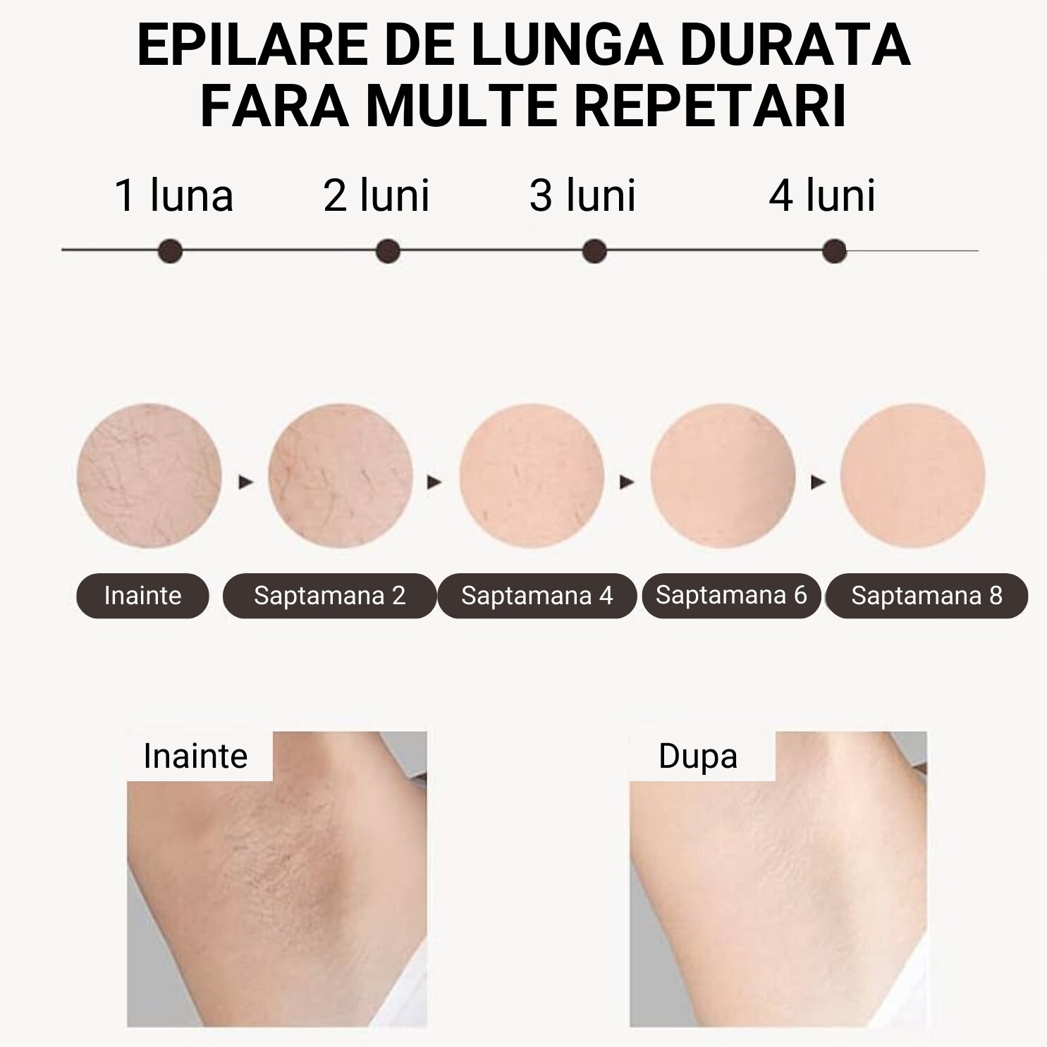 Epilator IPL Pentru Epilare Definitiva Profesionala, ProHink ...
