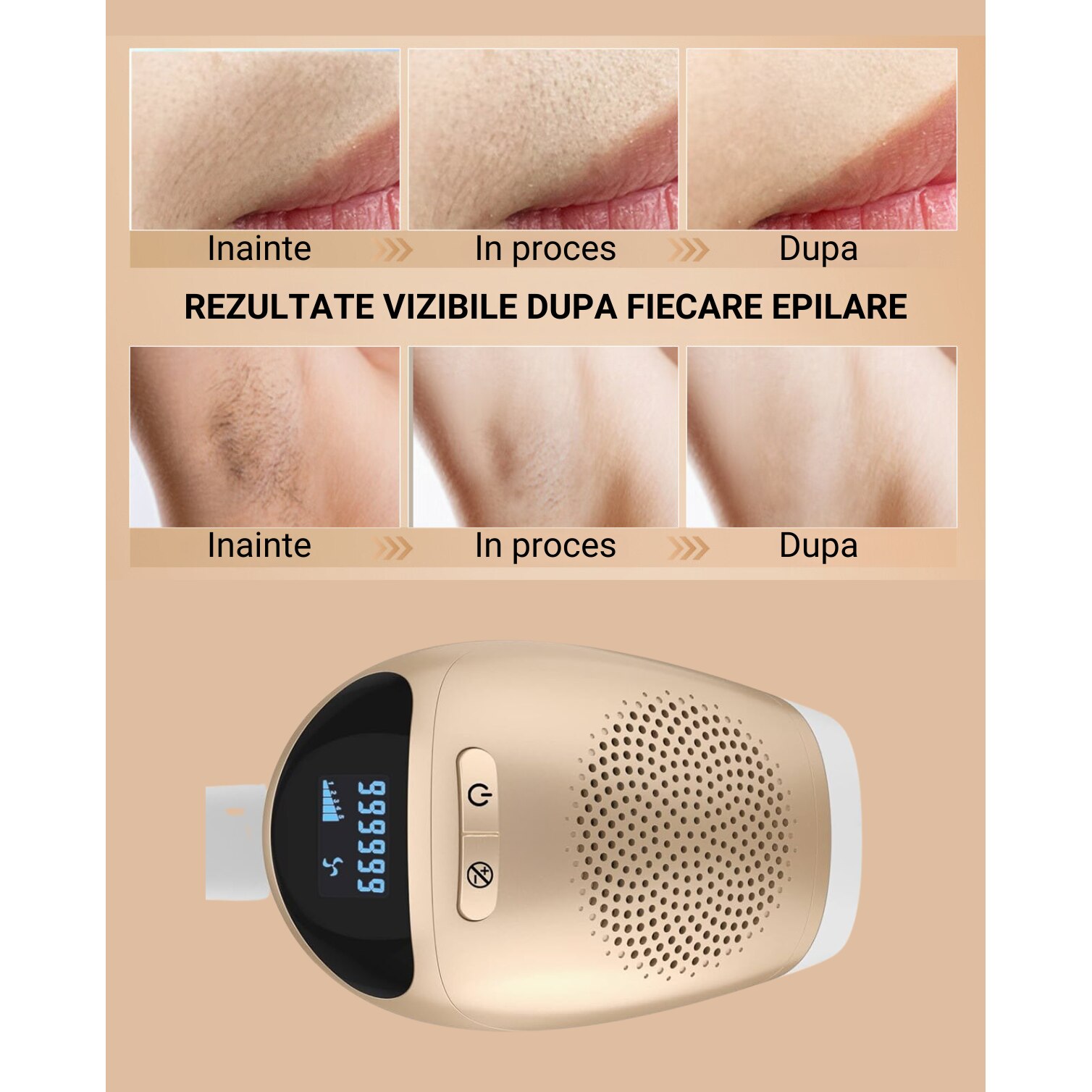 Epilator IPL Pentru Epilare Definitiva Profesionala, ProHink ...